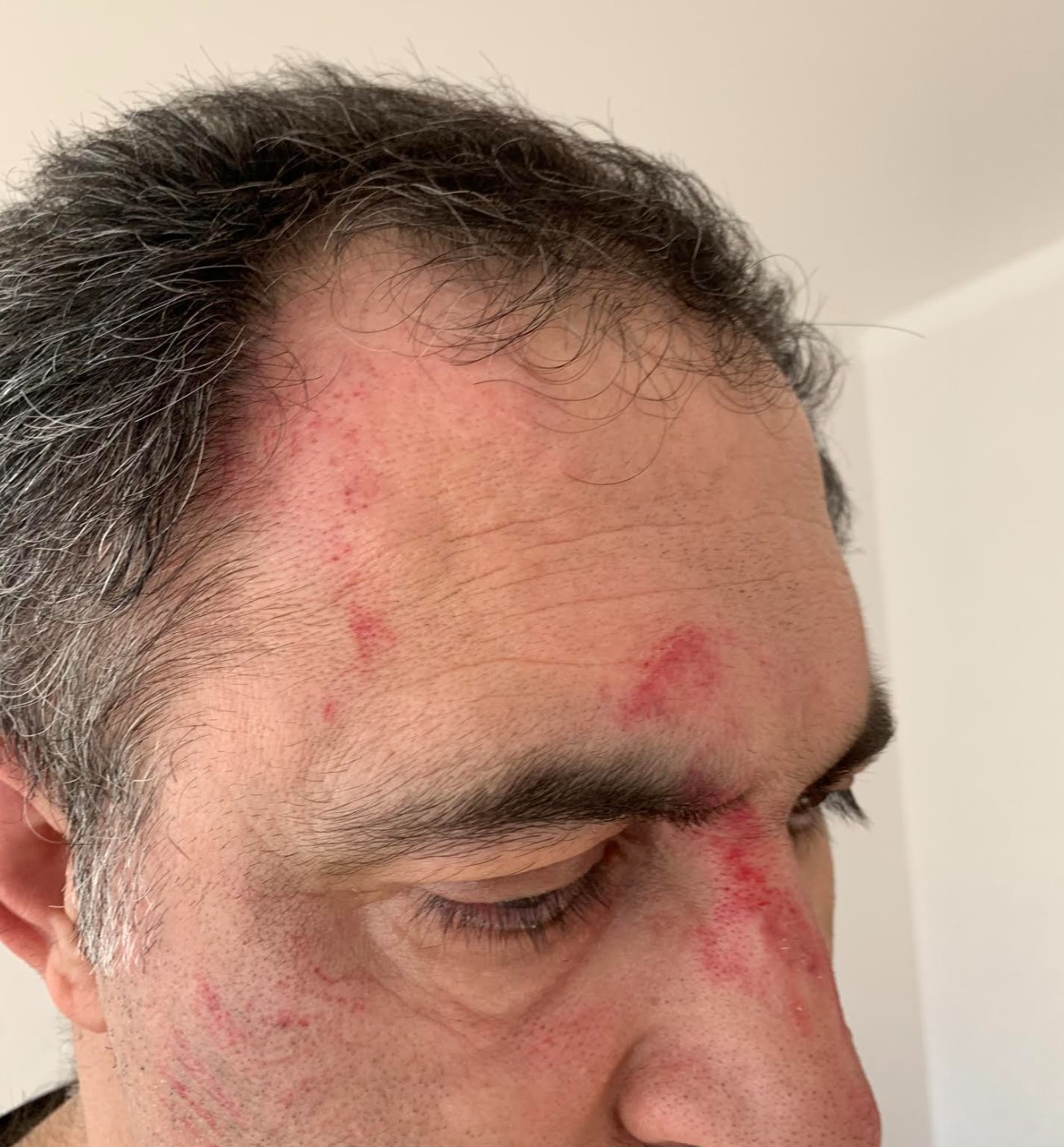 Exiled Turkish journalist attacked in Stockholm suburb - Nordic Monitor
